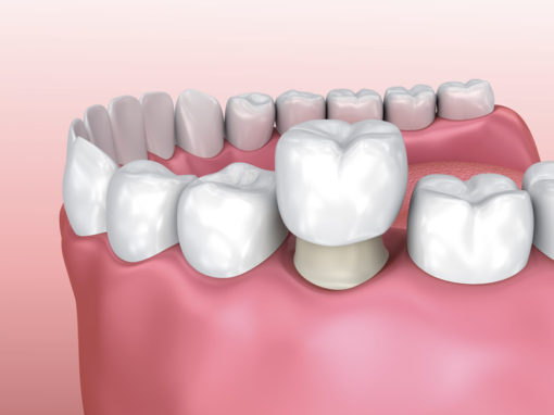 Our Dental Services - Coleshill Dental Centre