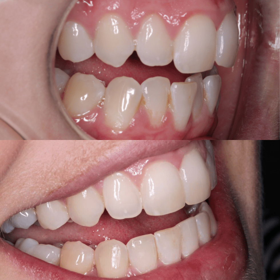 Coleshill Dental | NHS & Private Cosmetic Dentist Birmingham